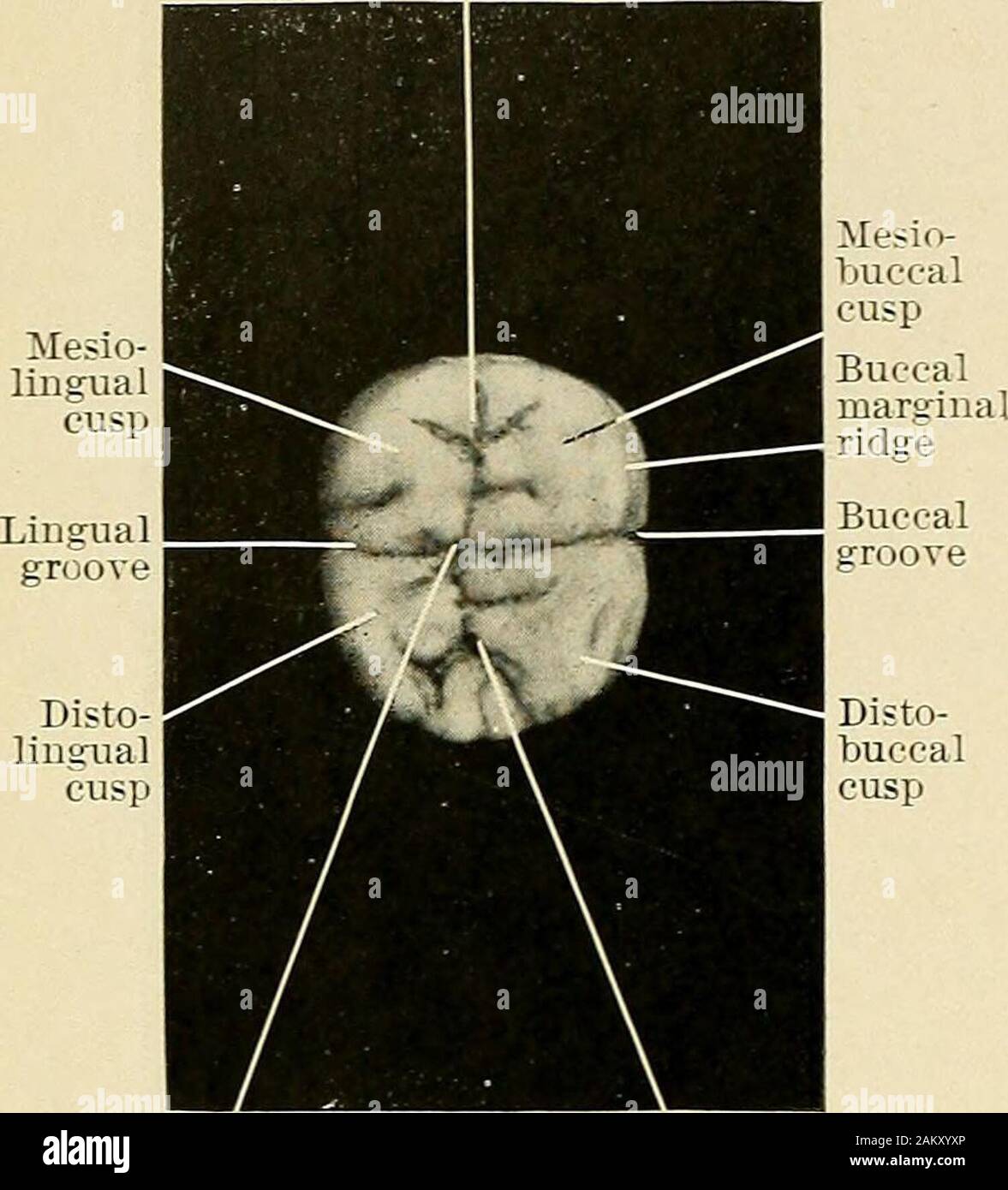 Molar inferior hi-res stock photography and images - Alamy