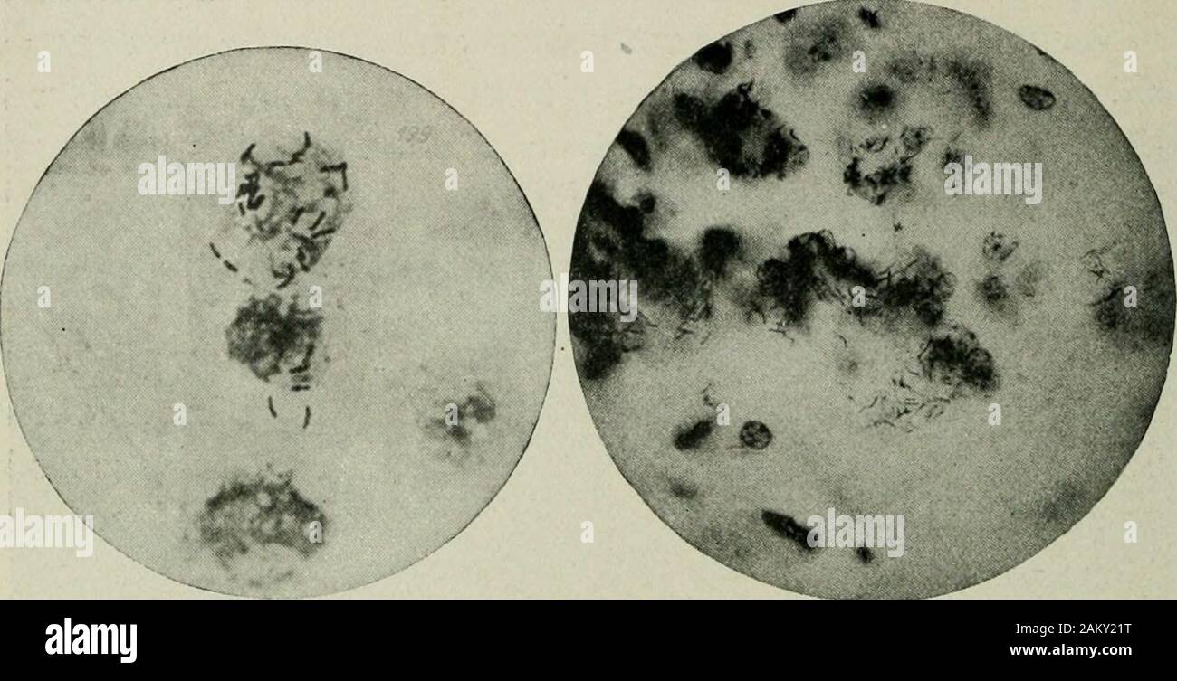 Diseases of swine, with particluar reference to hog-cholera . This germ ...
