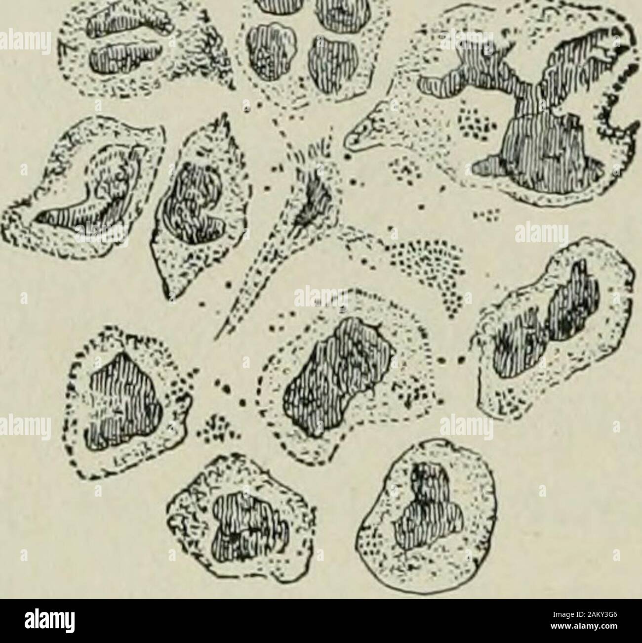 Cholera symptoms hi-res stock photography and images - Alamy