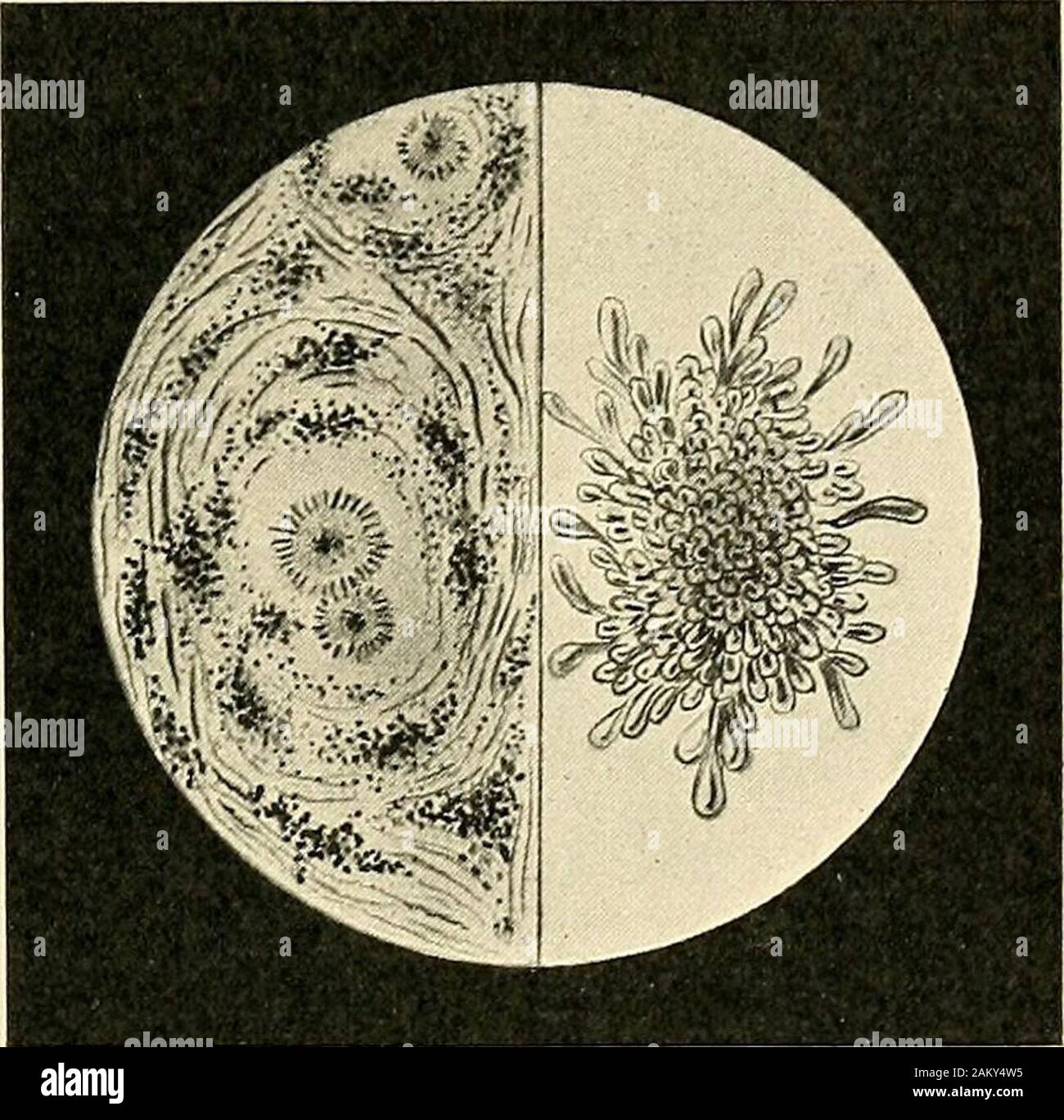 Lumpy jaw disease hi-res stock photography and images - Alamy