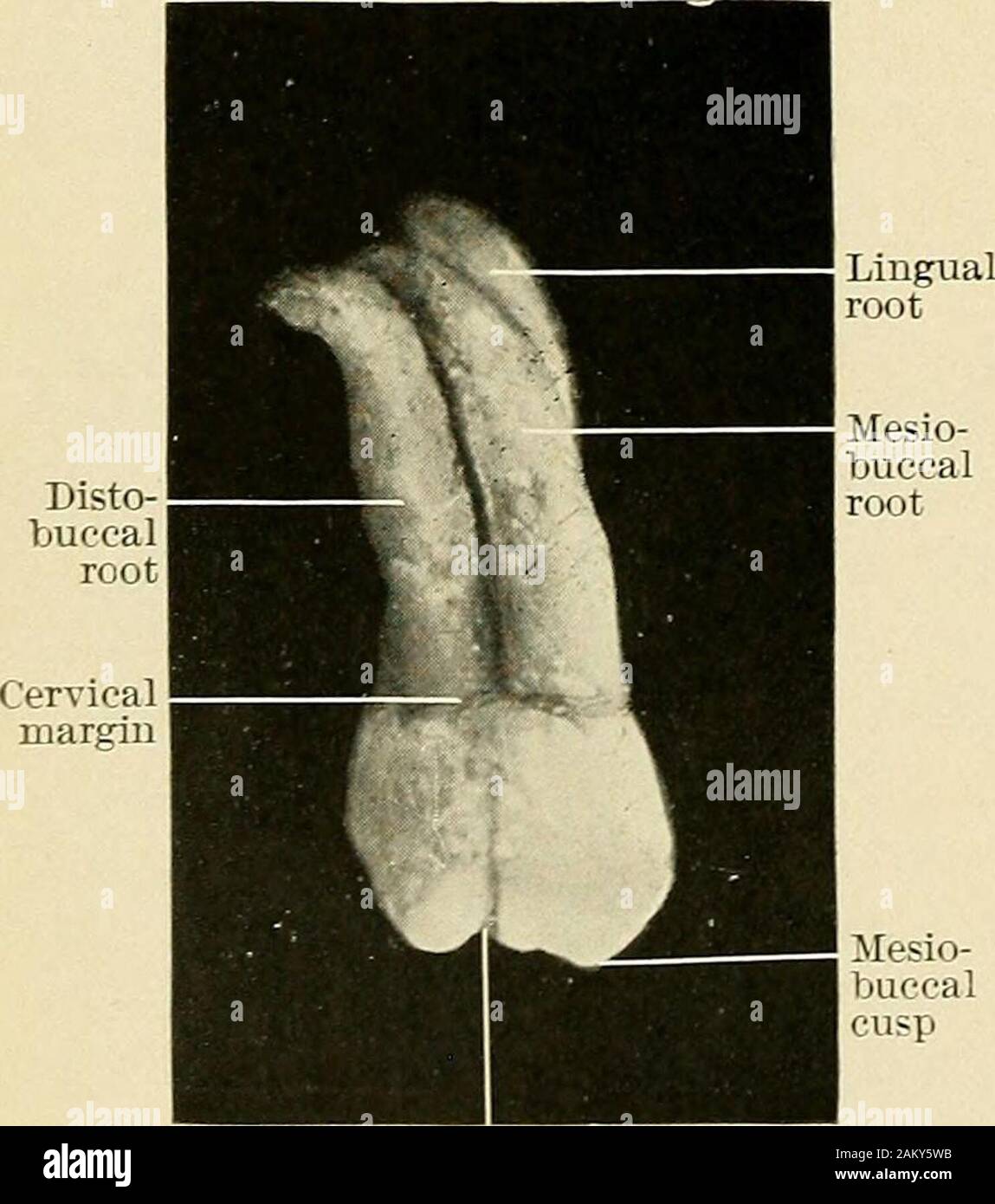 Principles and practice of operative dentistry . marginalridge Fig. 62 ...