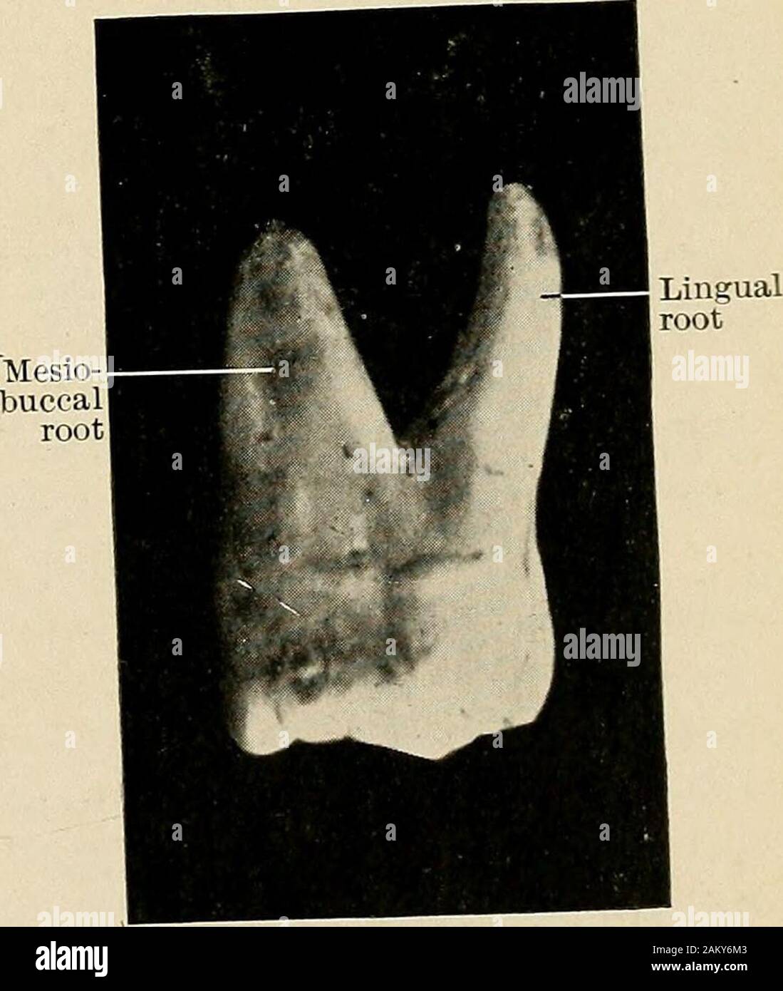 Principles and practice of operative dentistry . Lingual grooveFig. 59 ...