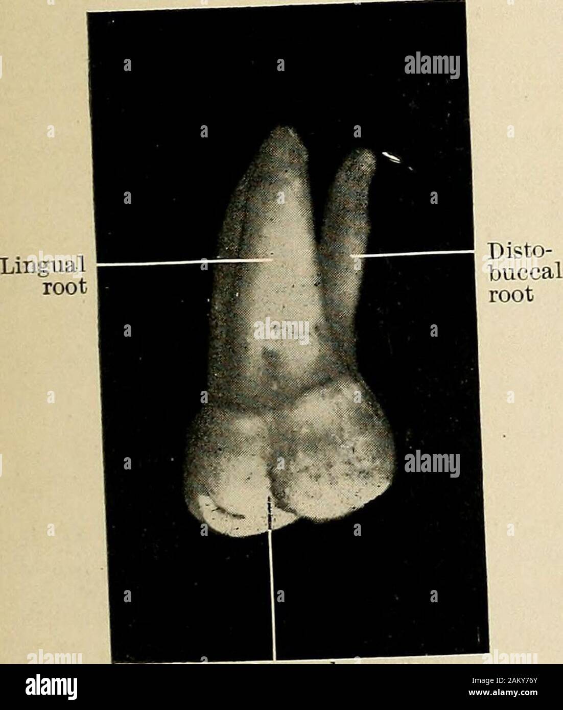 Buccal surface hi-res stock photography and images - Alamy