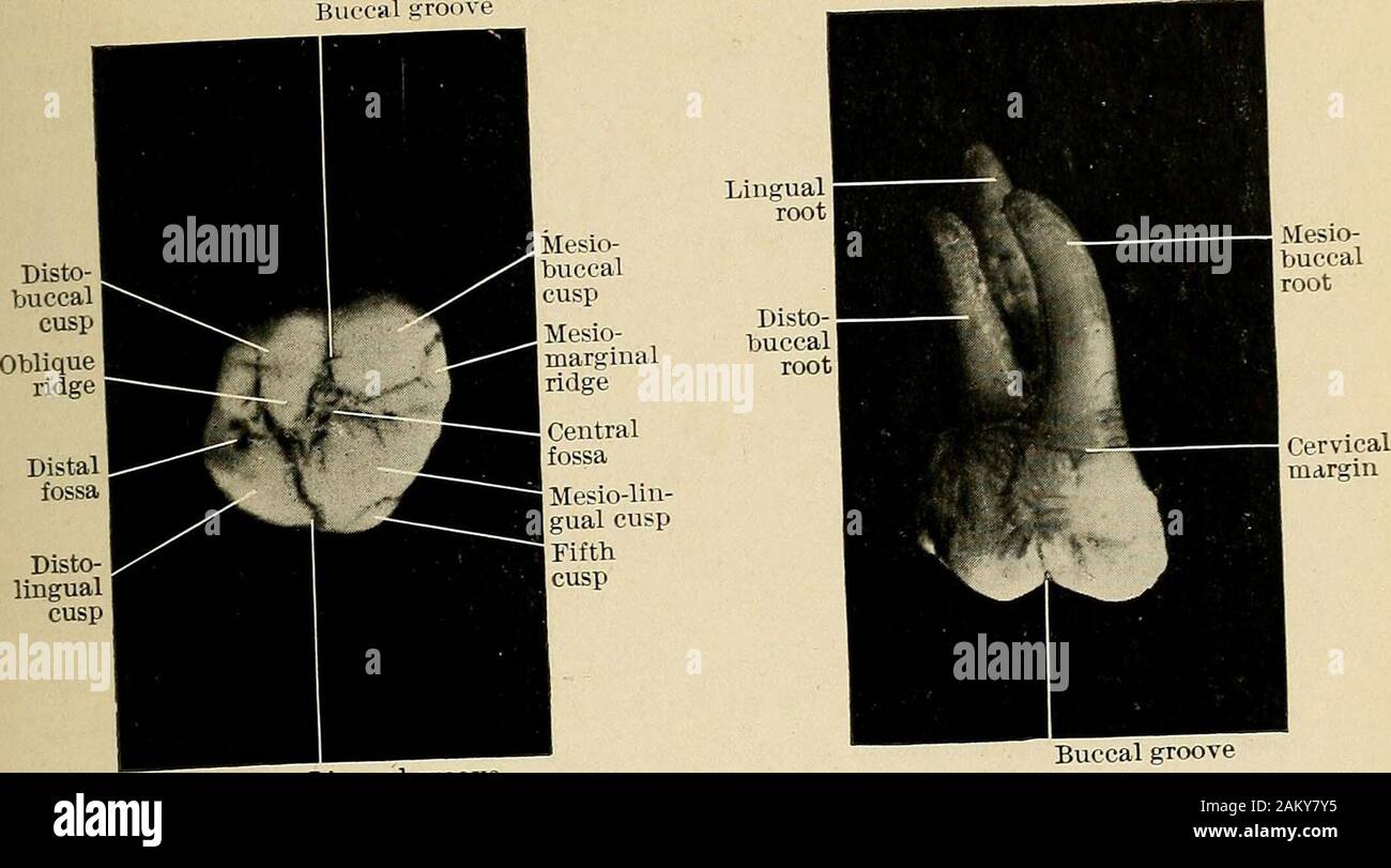 Principles and practice of operative dentistry . r than at the mesio ...
