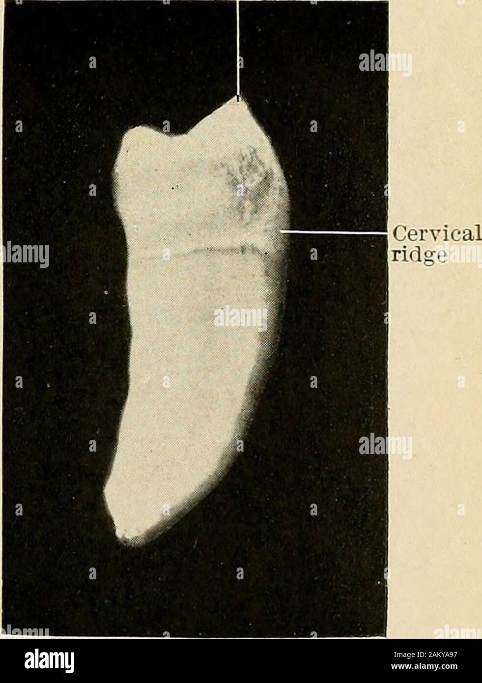 Principles and practice of operative dentistry . Buccal cusp. Fig. .51 ...