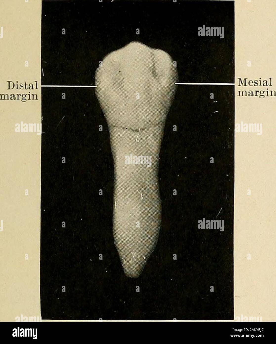Principles and practice of operative dentistry . surmounted by four ...