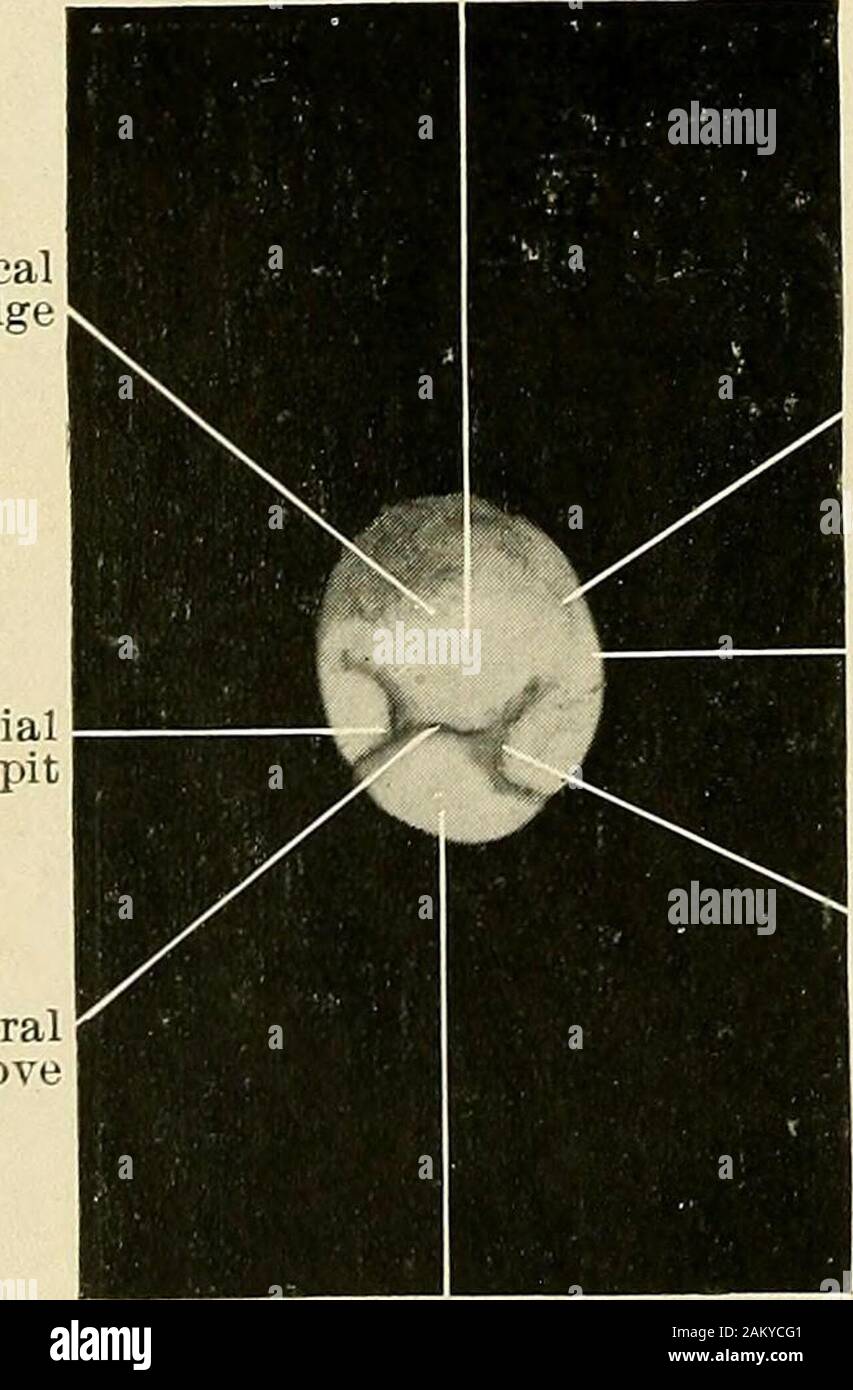 Disto hi-res stock photography and images - Alamy