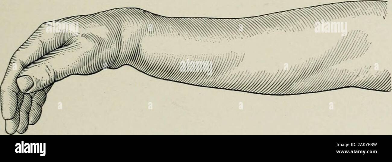 American practice of surgery : a complete system of the science and art ...