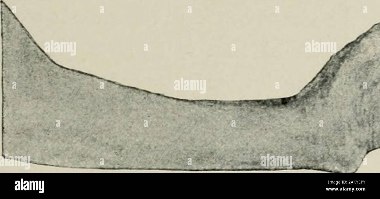 American practice of surgery : a complete system of the science and art ...