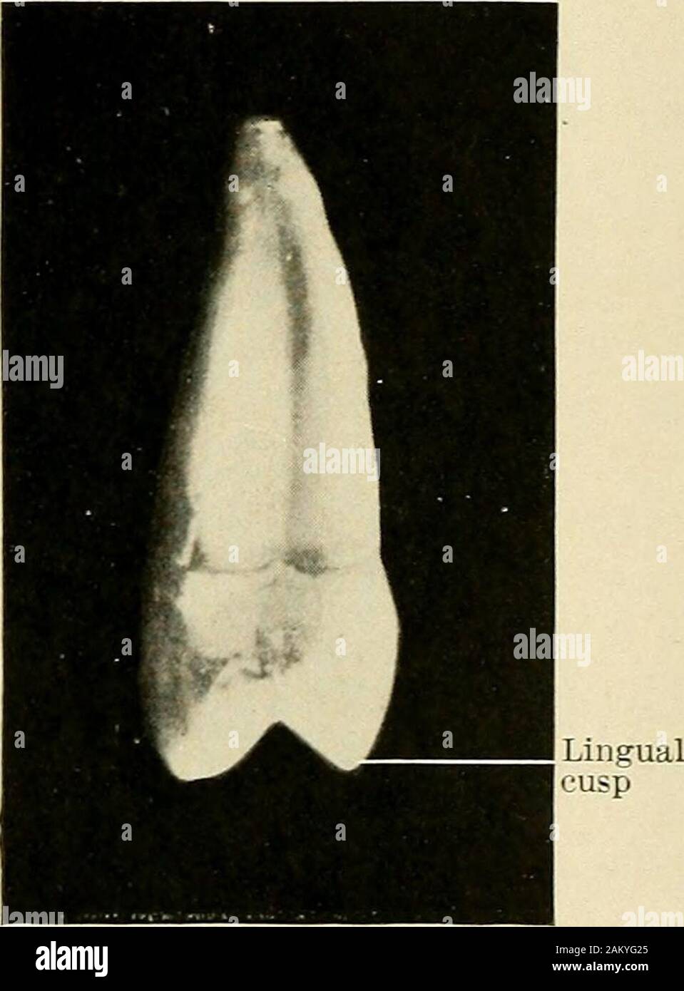Central sulcus hi-res stock photography and images - Alamy