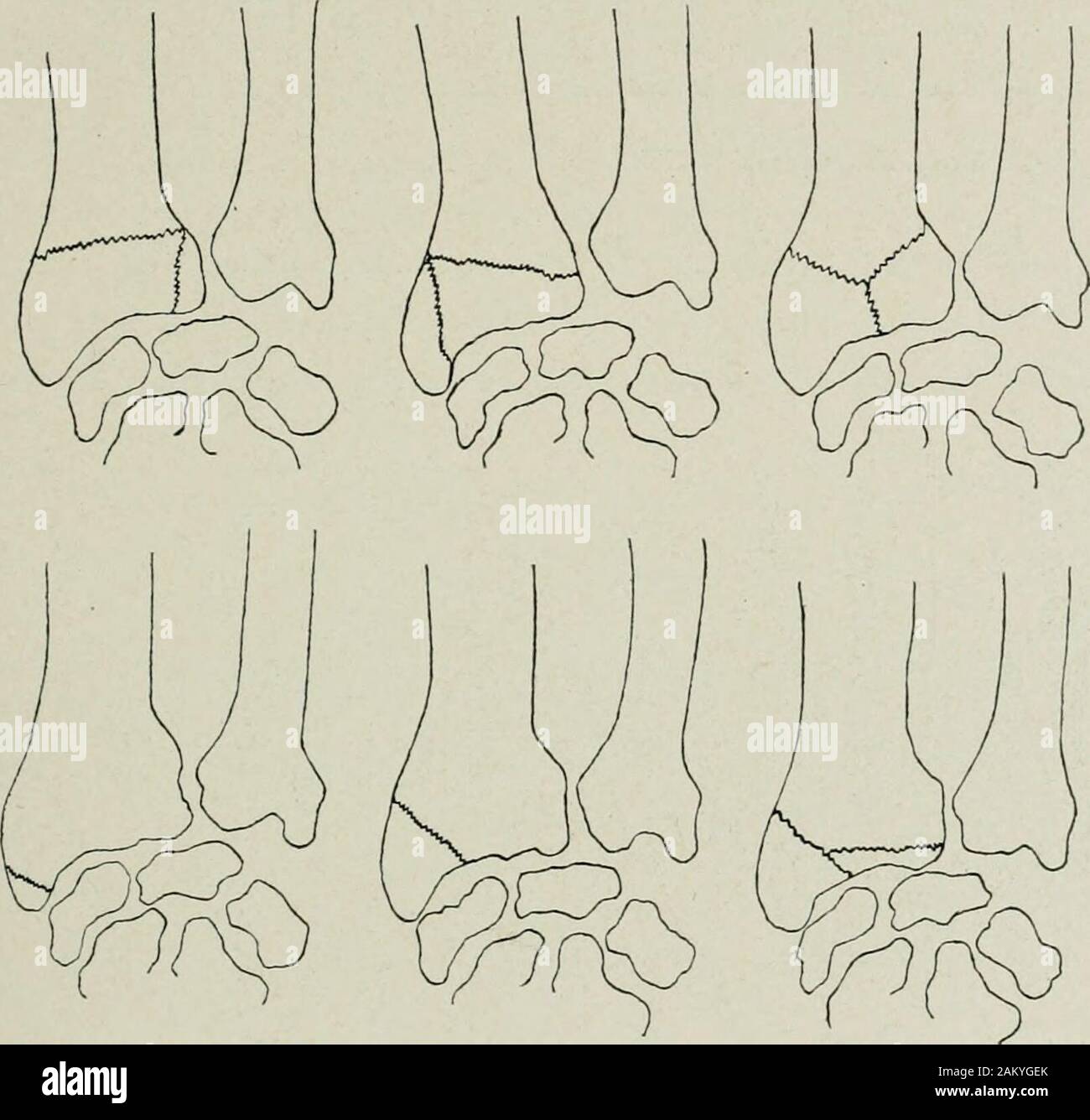 American practice of surgery : a complete system of the science and art ...