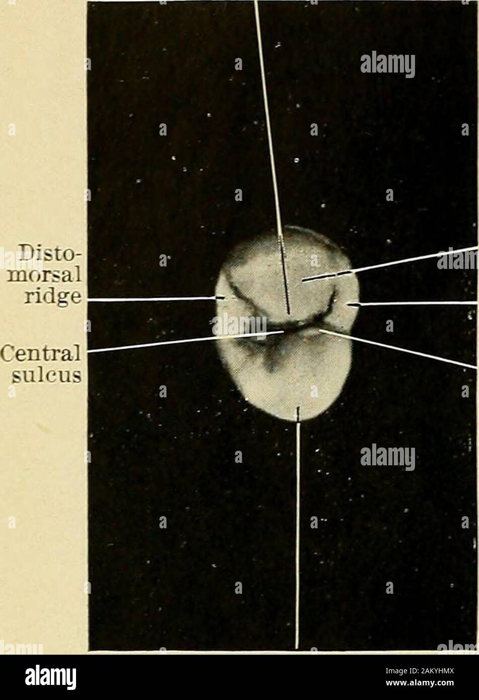 Principles and practice of operative dentistry . Fig. 36. Disto ...