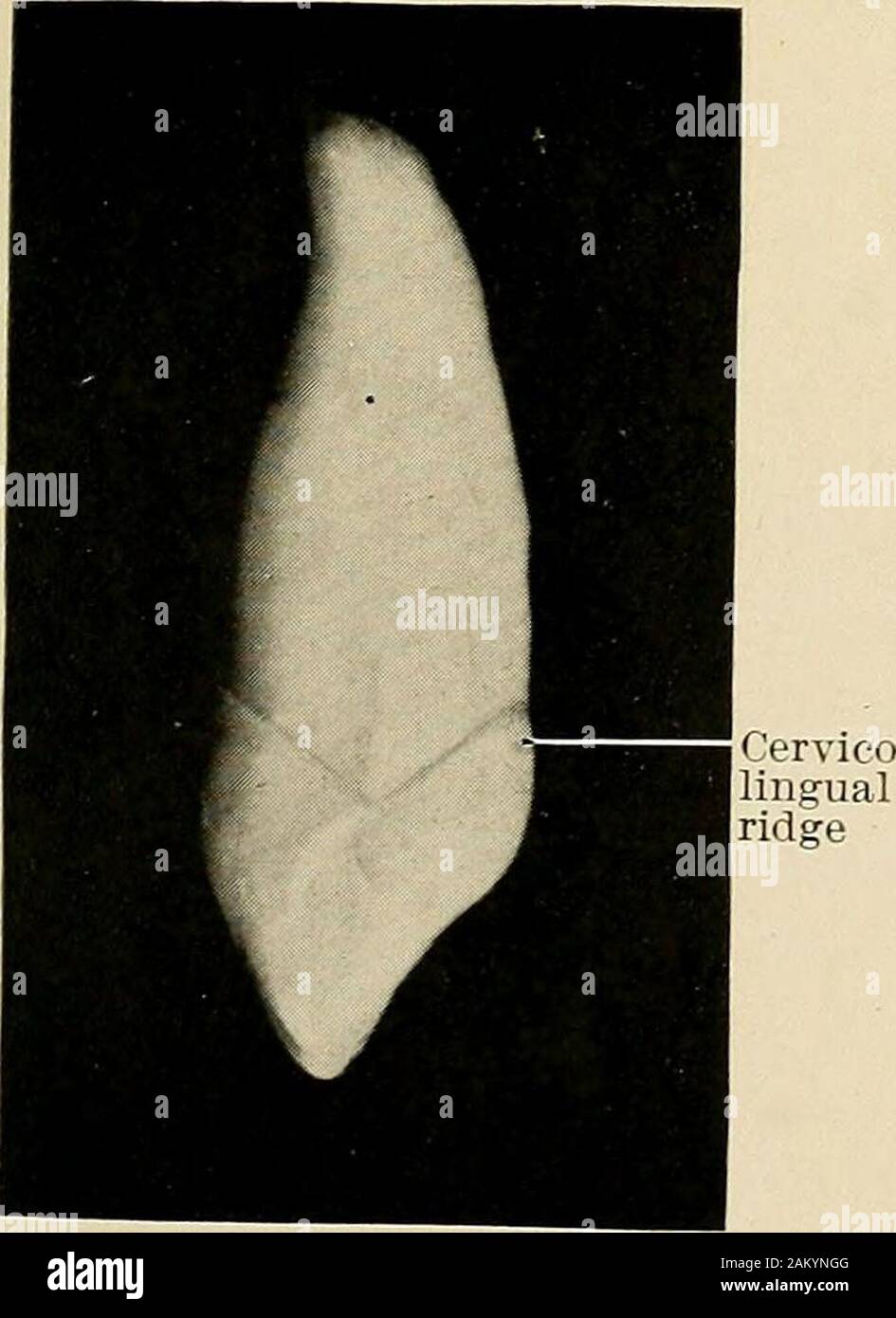 Superior labial hi-res stock photography and images - Alamy