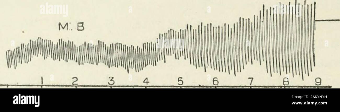 Kymograph hi-res stock photography and images - Alamy