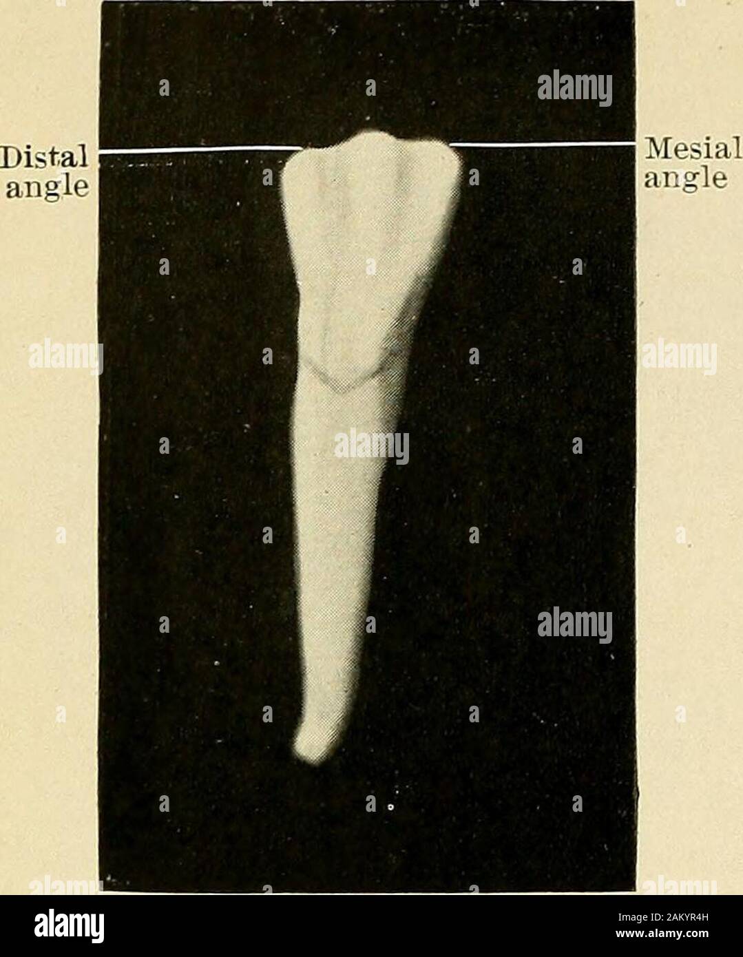 Principles and practice of operative dentistry . Fig. 19.—Inferior ...