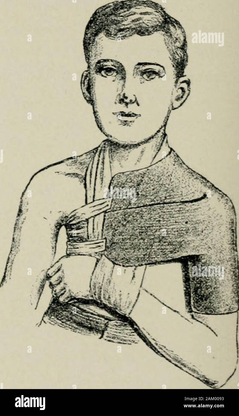 American practice of surgery : a complete system of the science and art ...