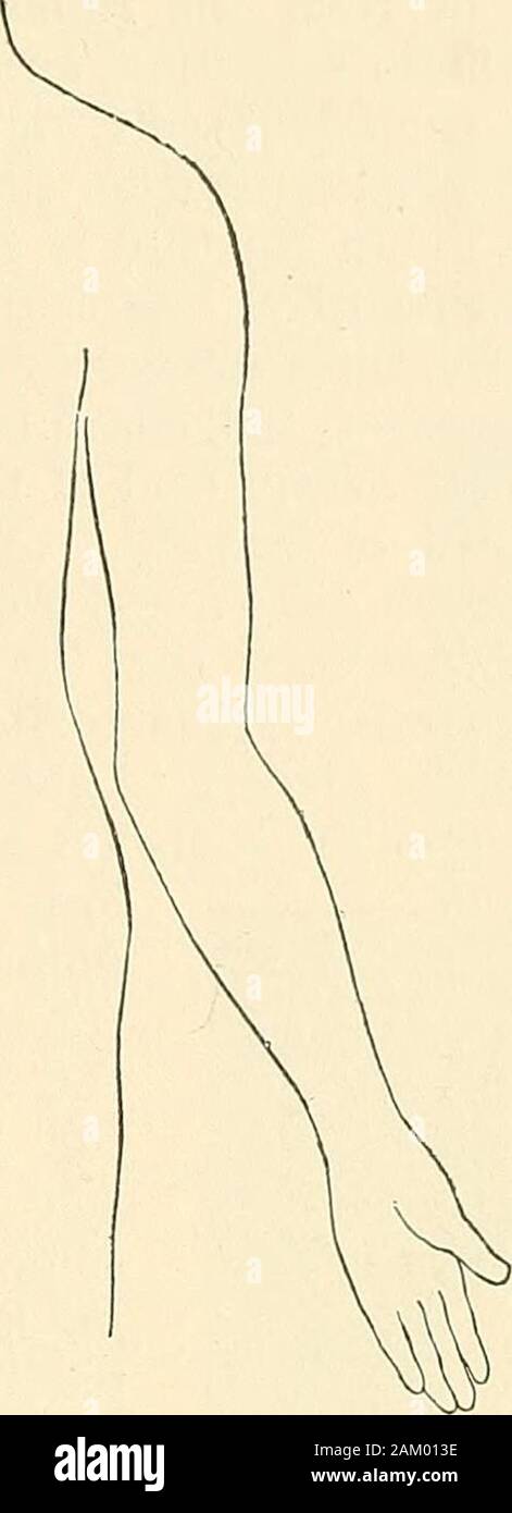 Modern surgery general operative hi-res stock photography and images ...