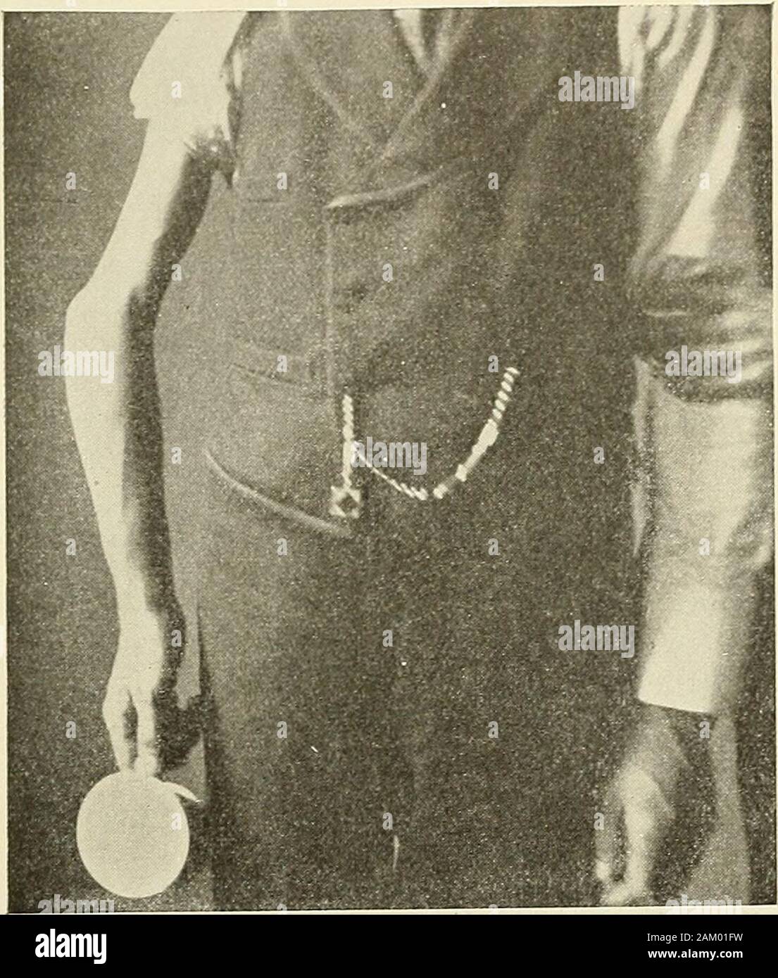 Lower limb function hi-res stock photography and images - Alamy