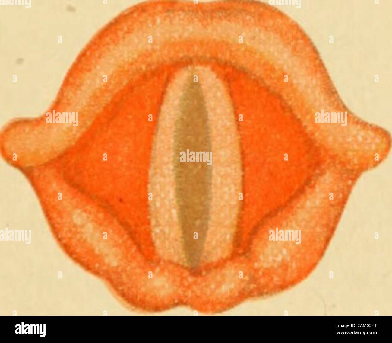 Severe laryngitis hi-res stock photography and images - Alamy