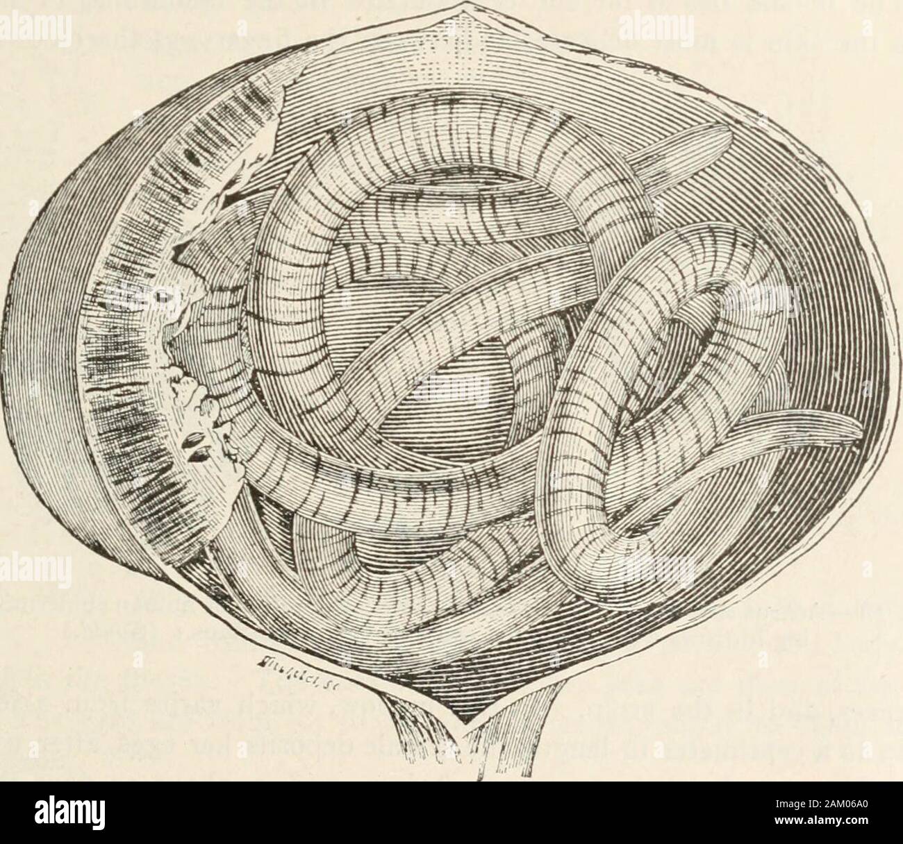 Opisthorchis hi-res stock photography and images - Alamy
