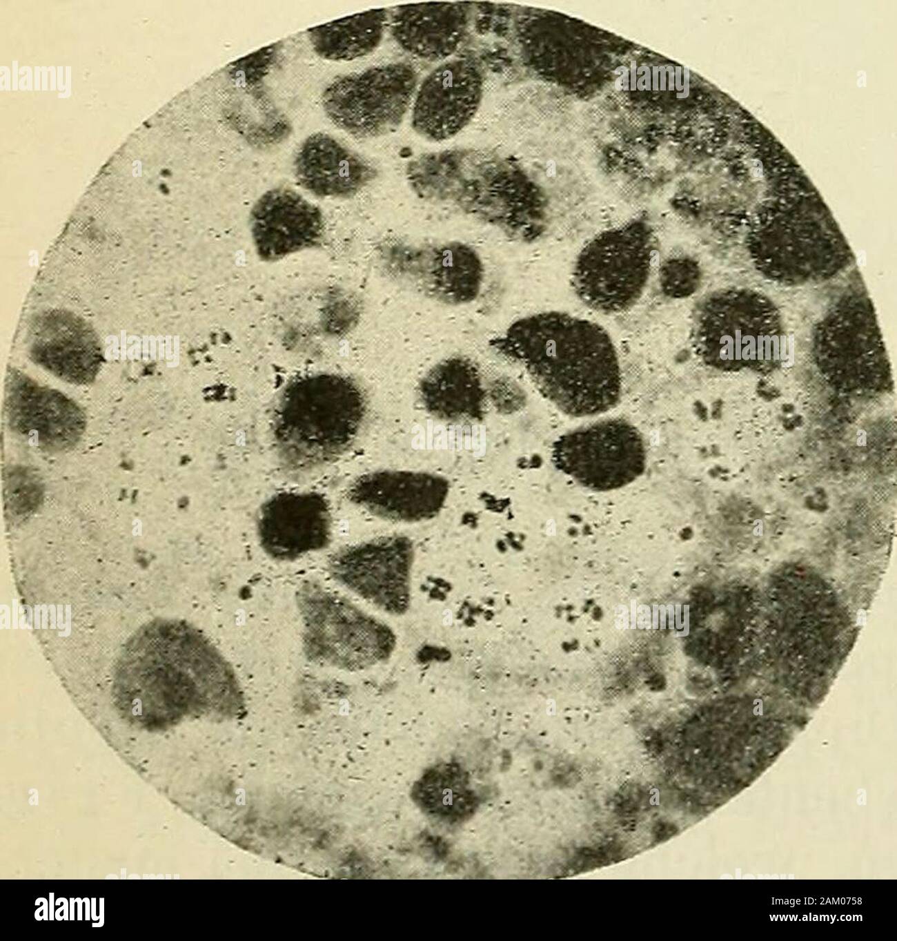 Leptothrix buccalis hi-res stock photography and images - Alamy