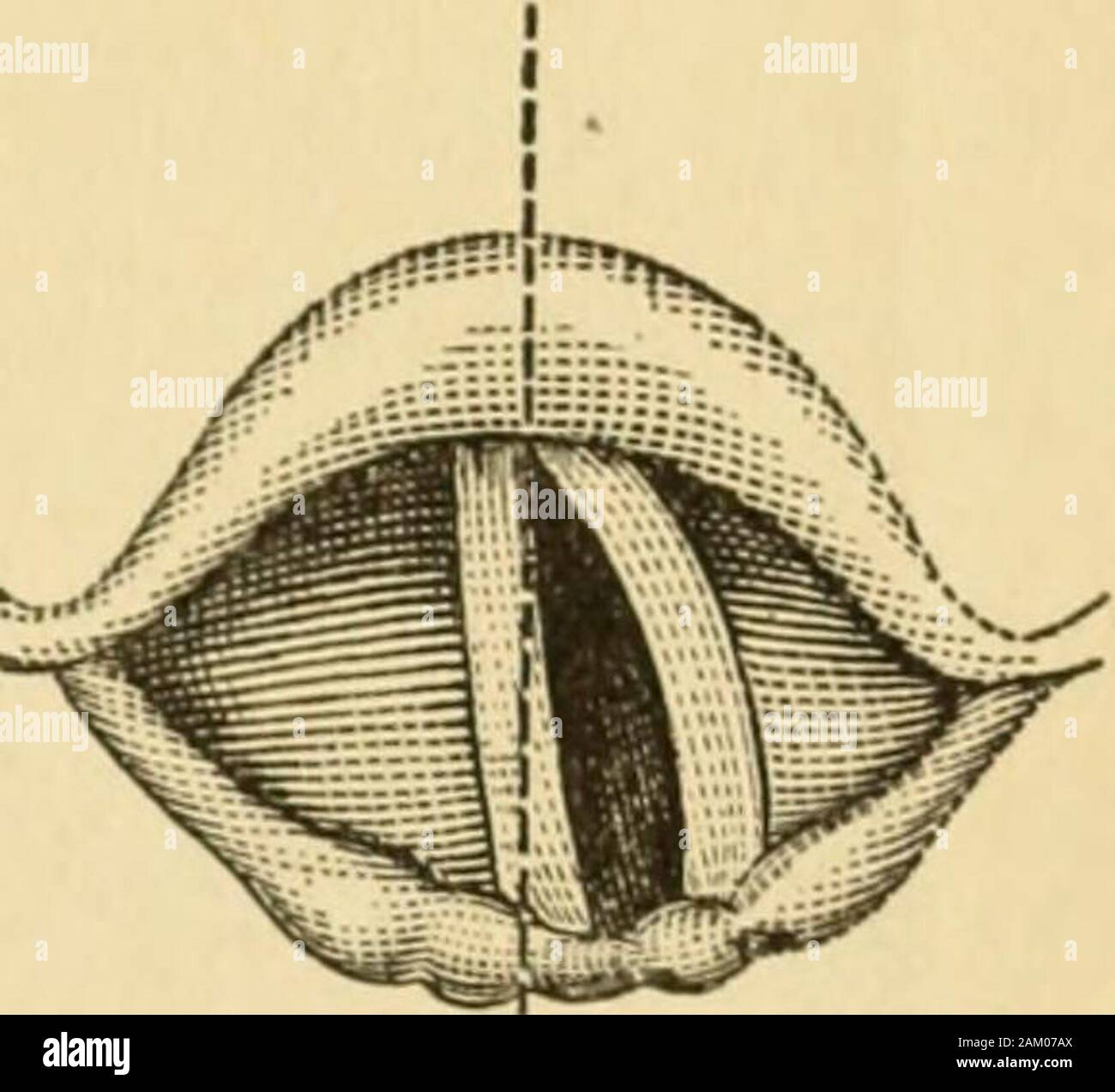 Arytenoid fold hi-res stock photography and images - Alamy
