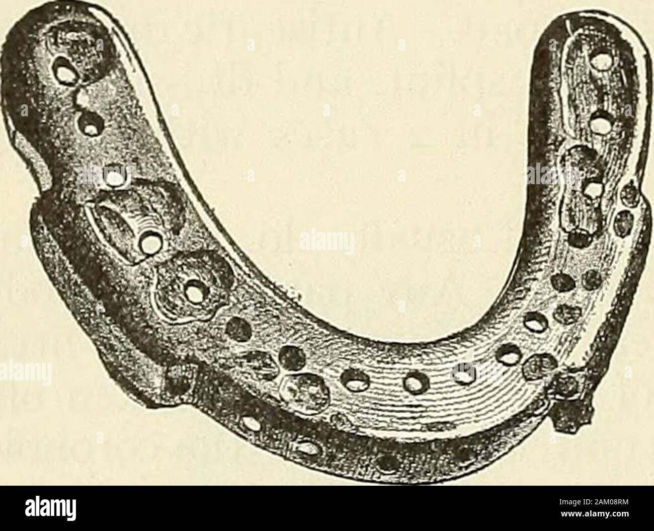 Modern surgery, general and operative . Fig. 2gi.—Hamiltons bandage ...