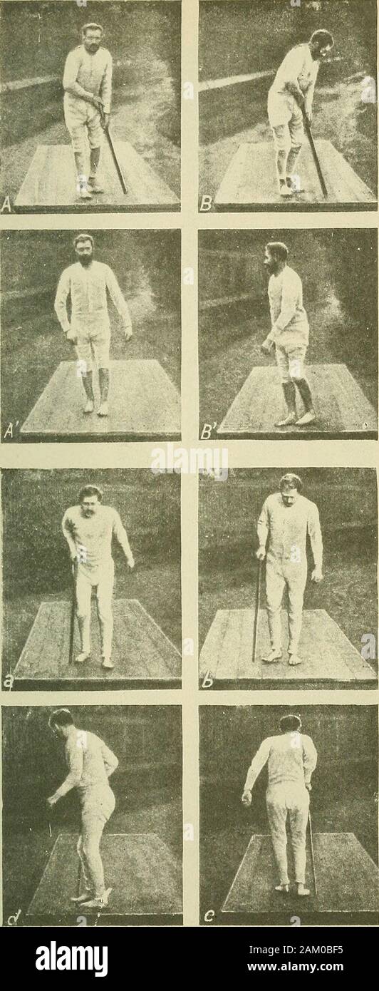 Medical and surgical therapy . A.-J.—Functional paraplegia, spasmodic ...