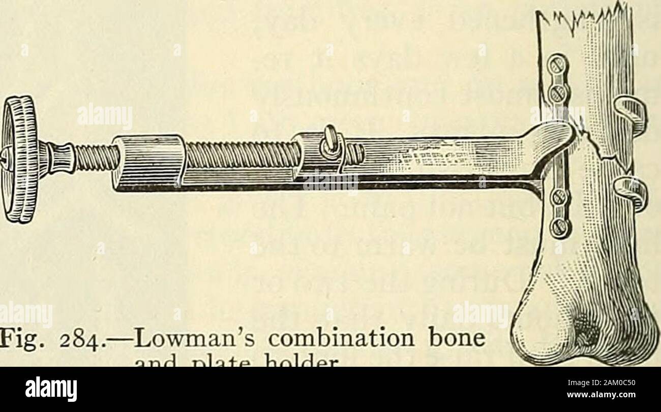 Modern surgery, general and operative . Fig. 2 ^.—Lowmans combination ...