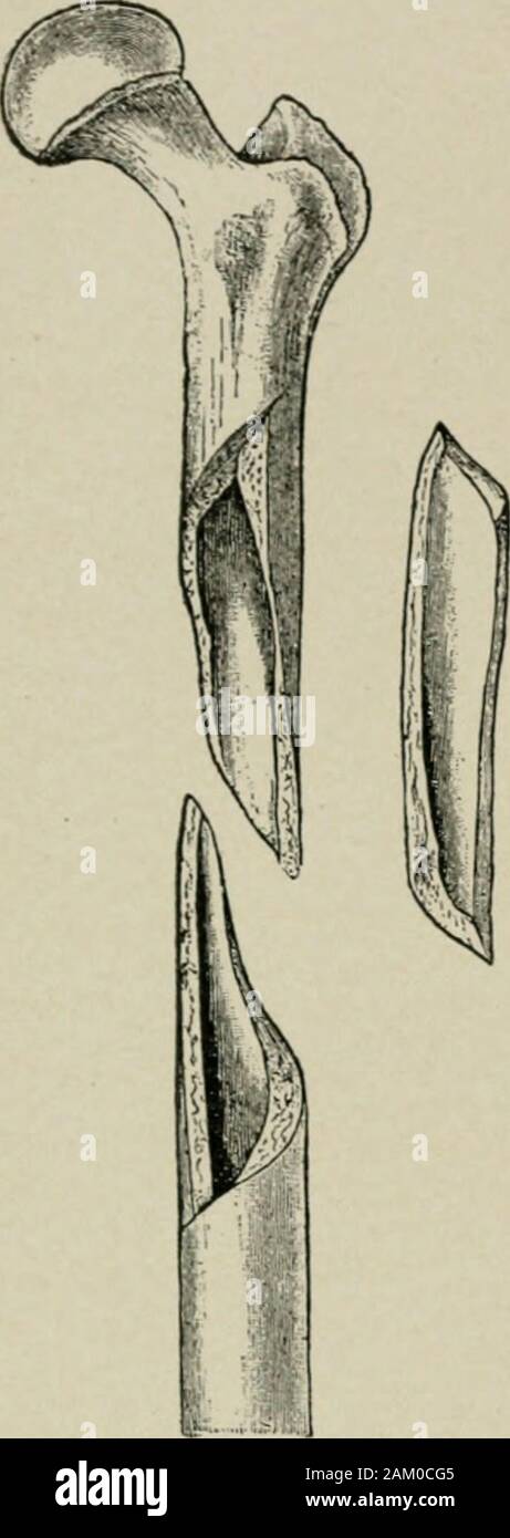 American practice of surgery : a complete system of the science and art ...