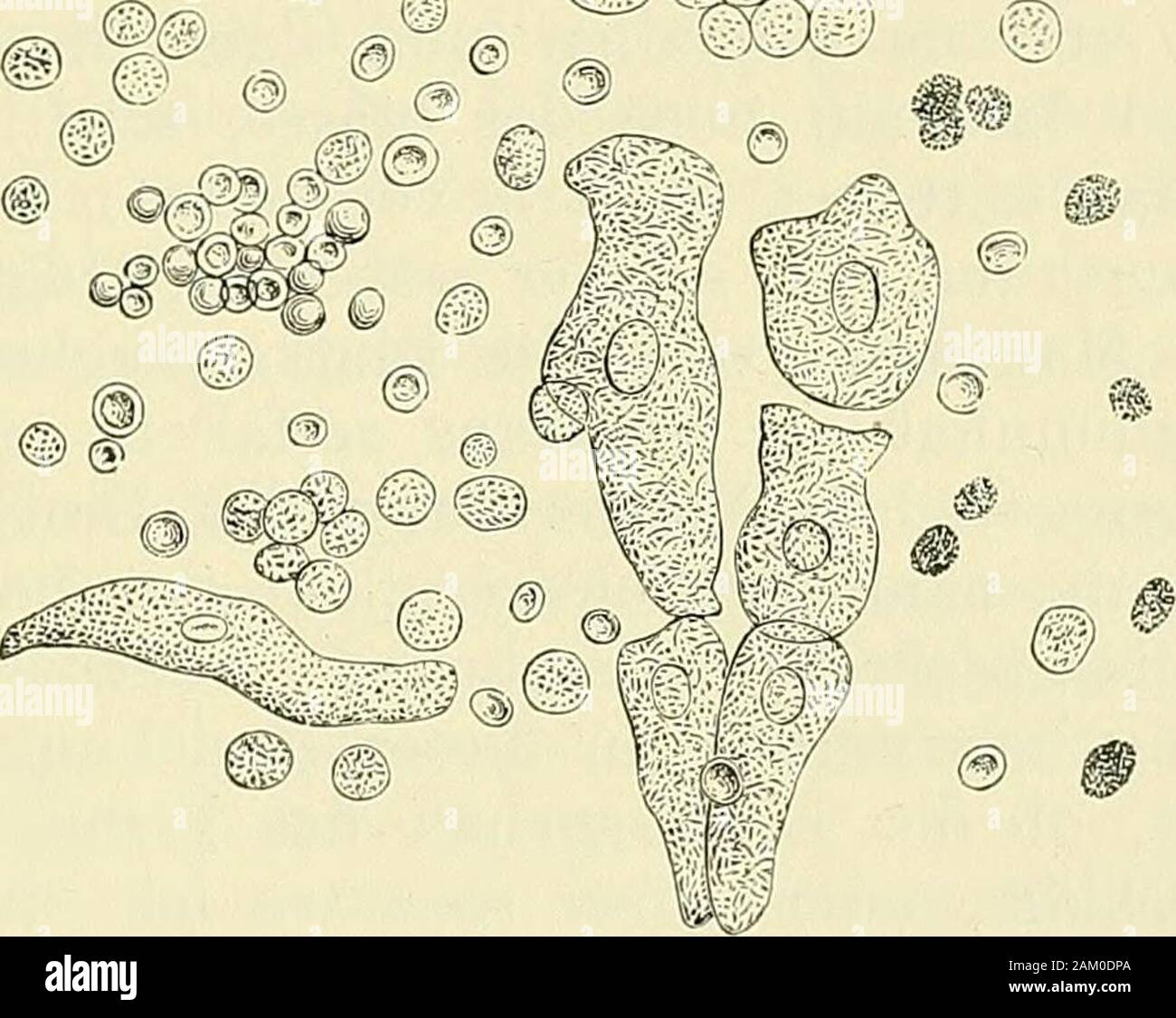 Pyelitis hi-res stock photography and images - Alamy