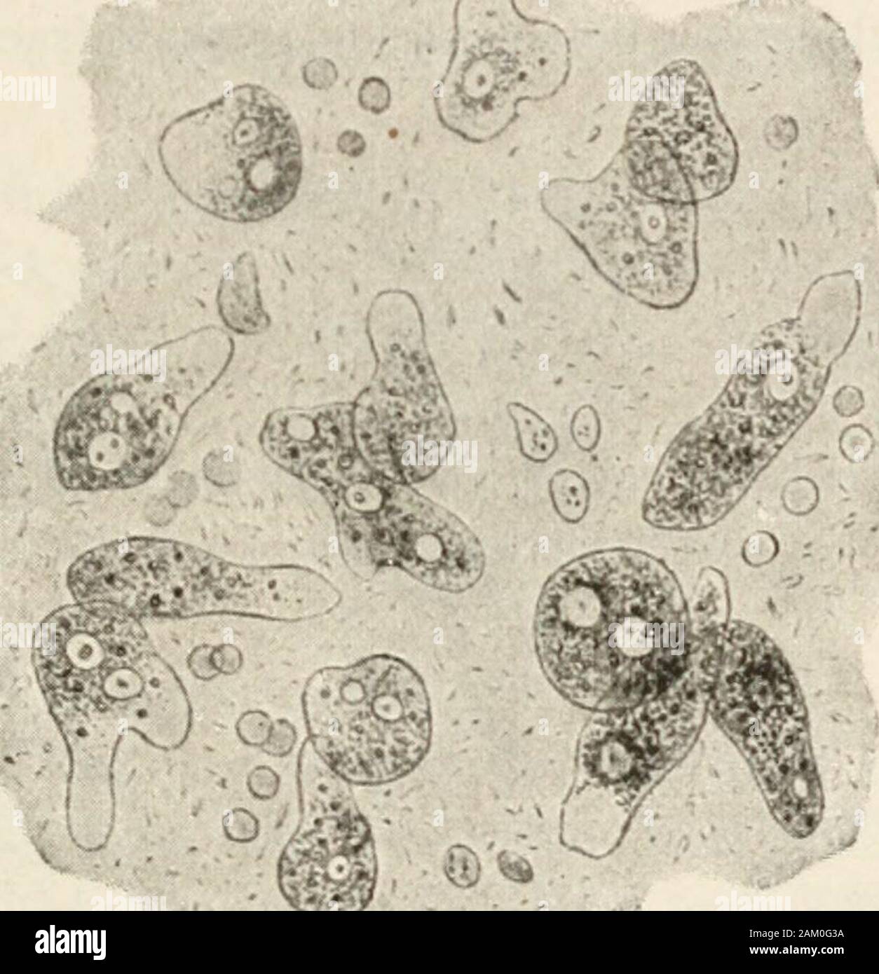 Bacillary dysentery hi-res stock photography and images - Alamy