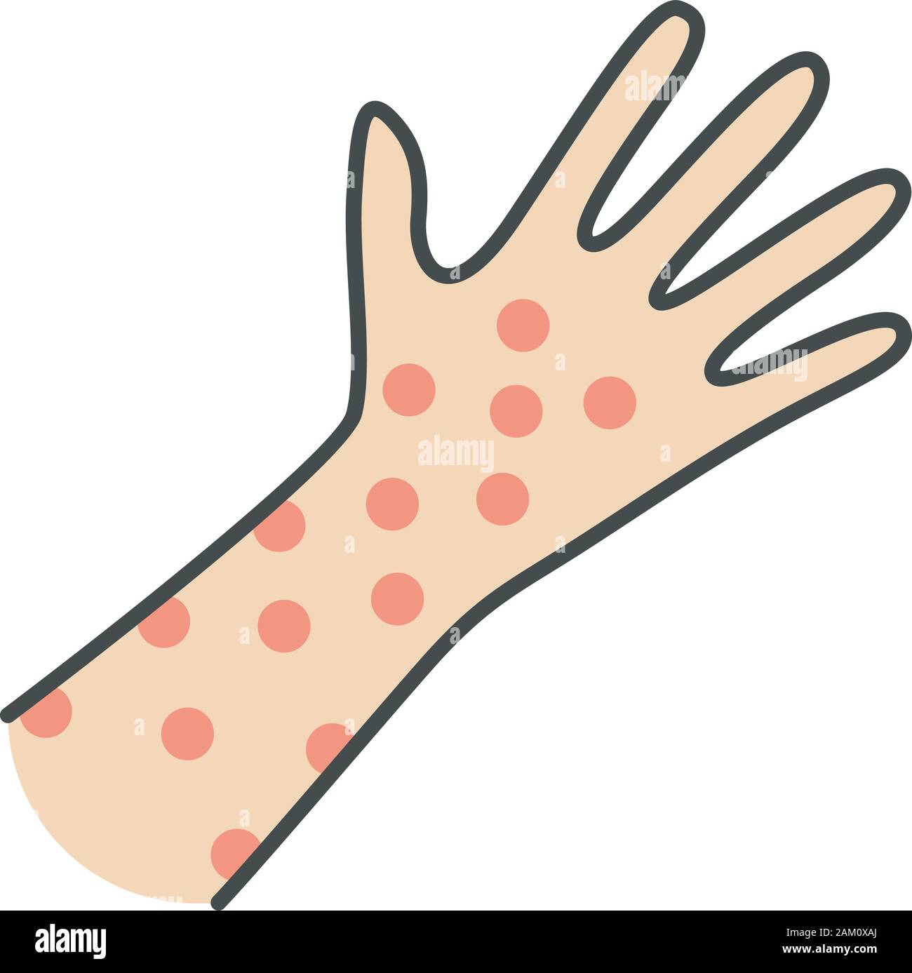 Skin rash, hives color icon. Food, medication, insect bites allergy ...