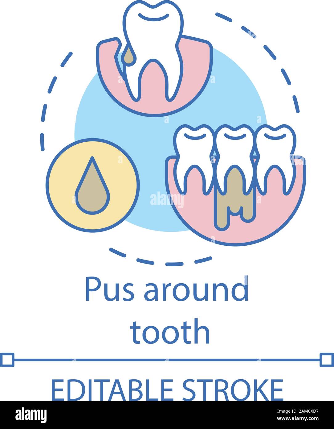 Pus around tooth concept icon. Oral disease. Infectious lesion of mouth ...