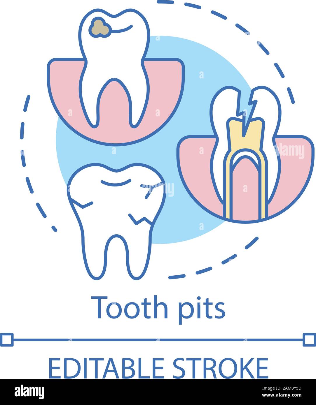 Tooth pits concept icon. Enamel destruction, caries. General dental ...