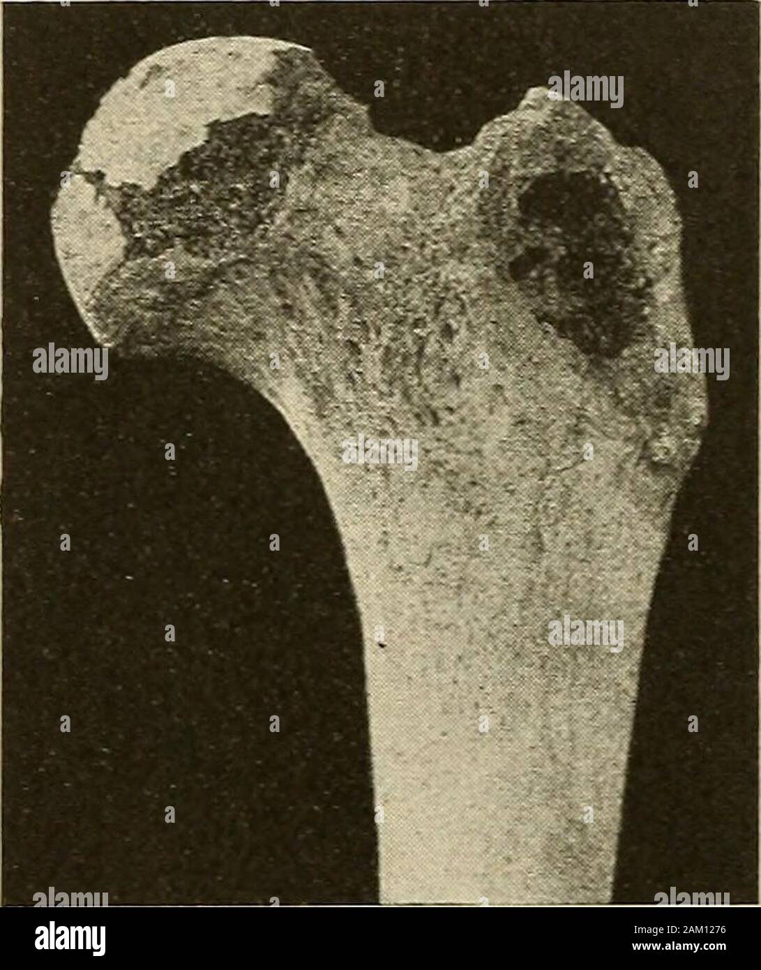 Modern surgery, general and operative . nature, further away the old ...