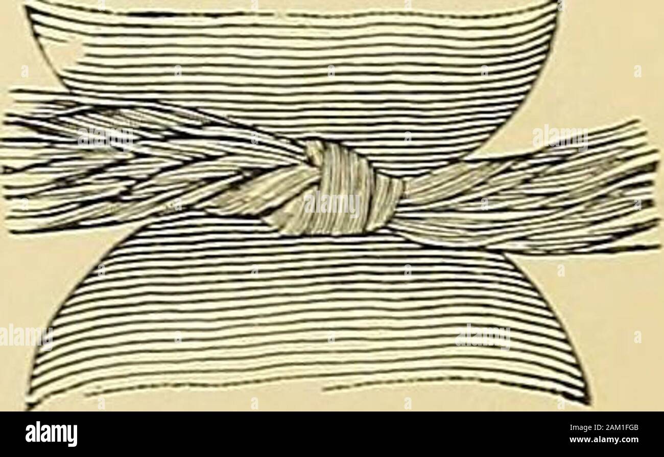 Modern surgery, general and operative . 7. Opening the Sheath for ...