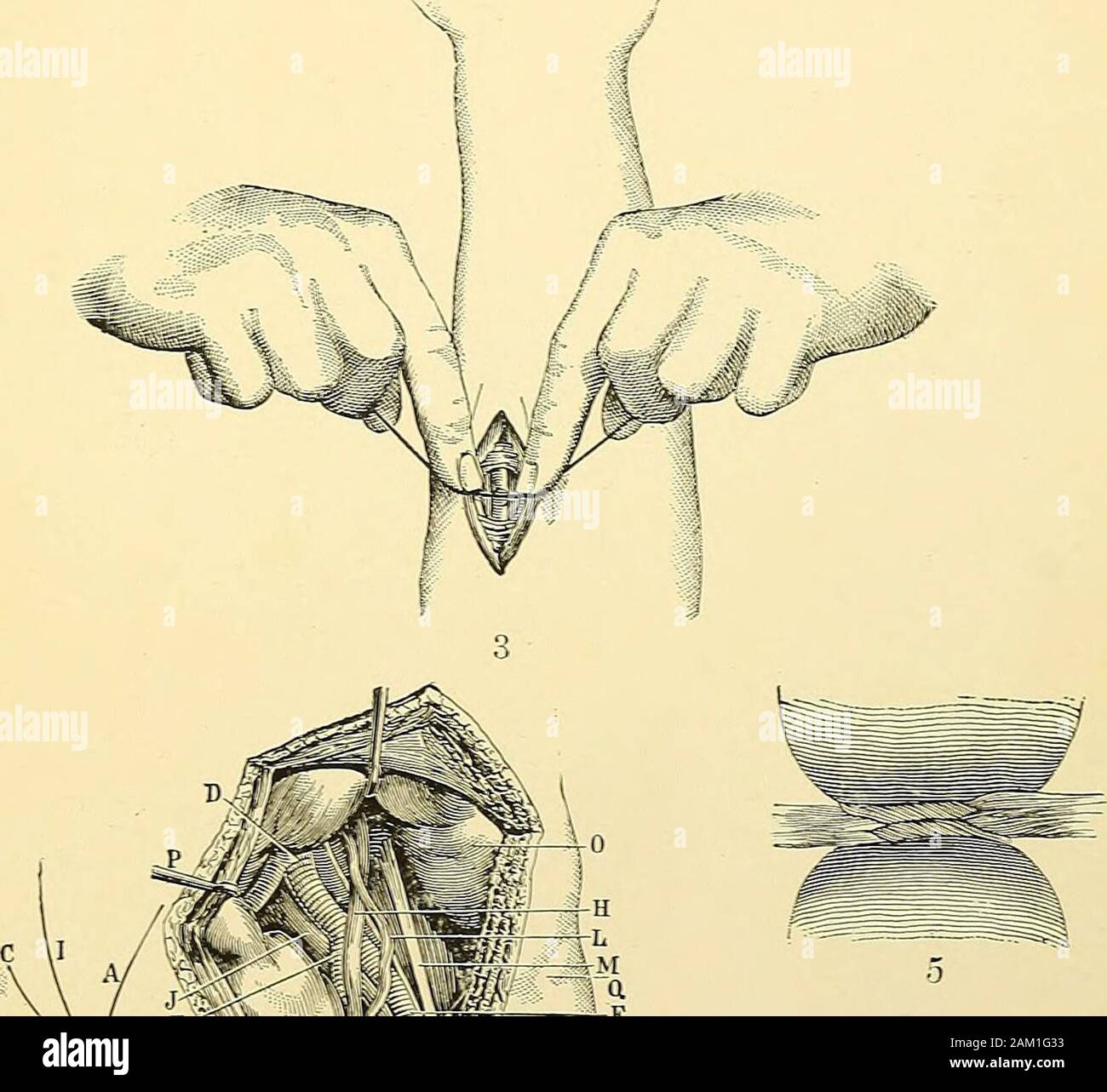 Modern surgery general operative hi-res stock photography and images ...