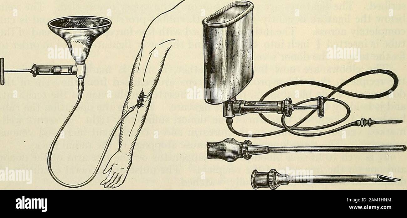 Modern surgery, general and operative . Fig. 235.—^Intravenous saline ...
