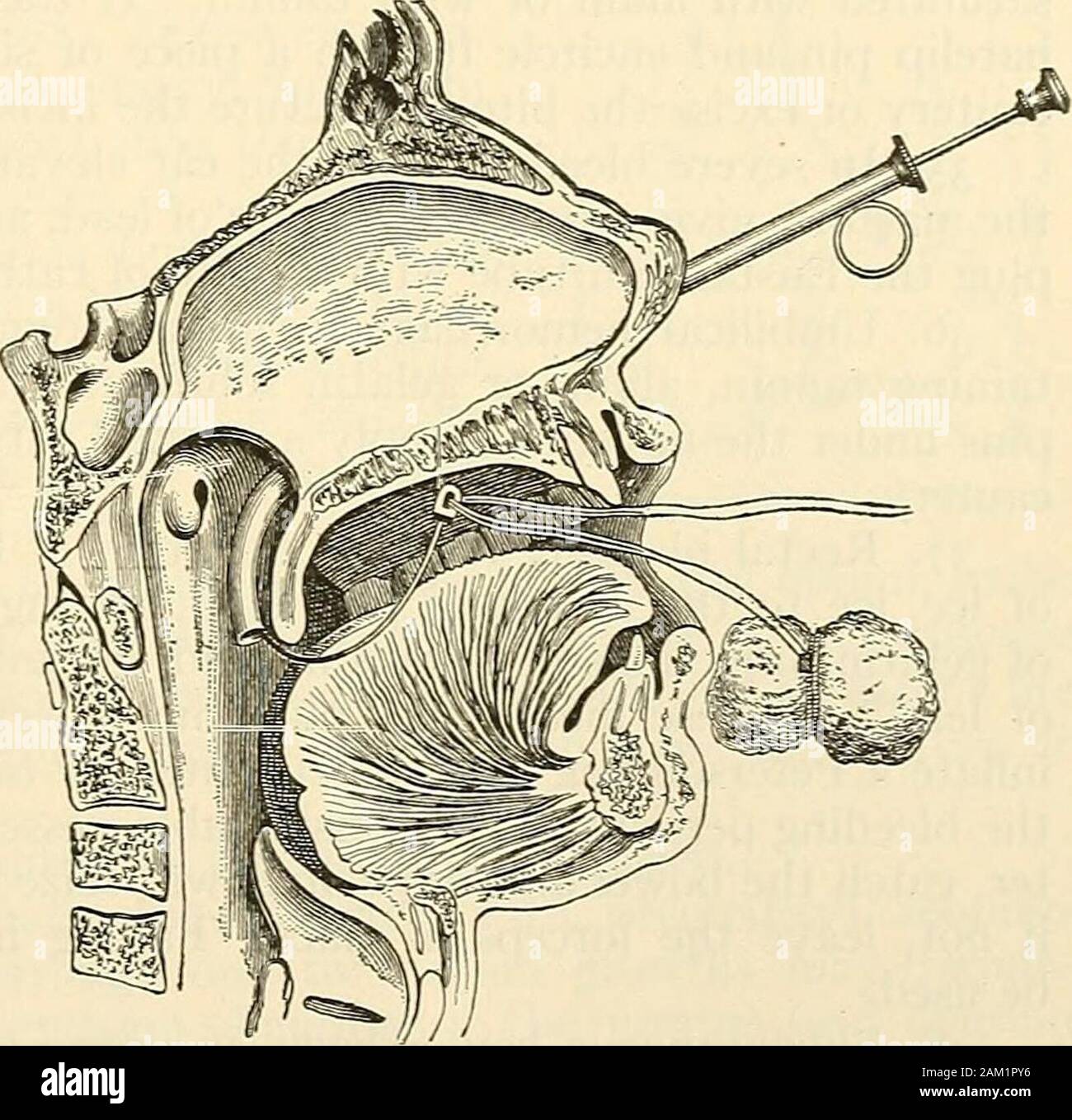 Arterial bleeding hi-res stock photography and images - Alamy