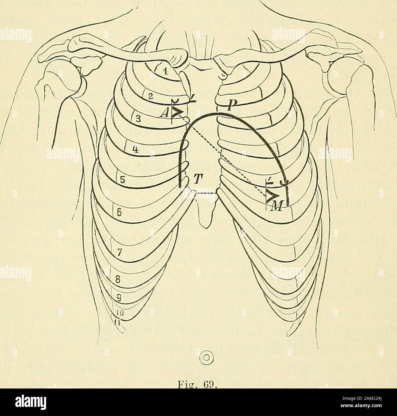 Minima and maxima hi-res stock photography and images - Alamy