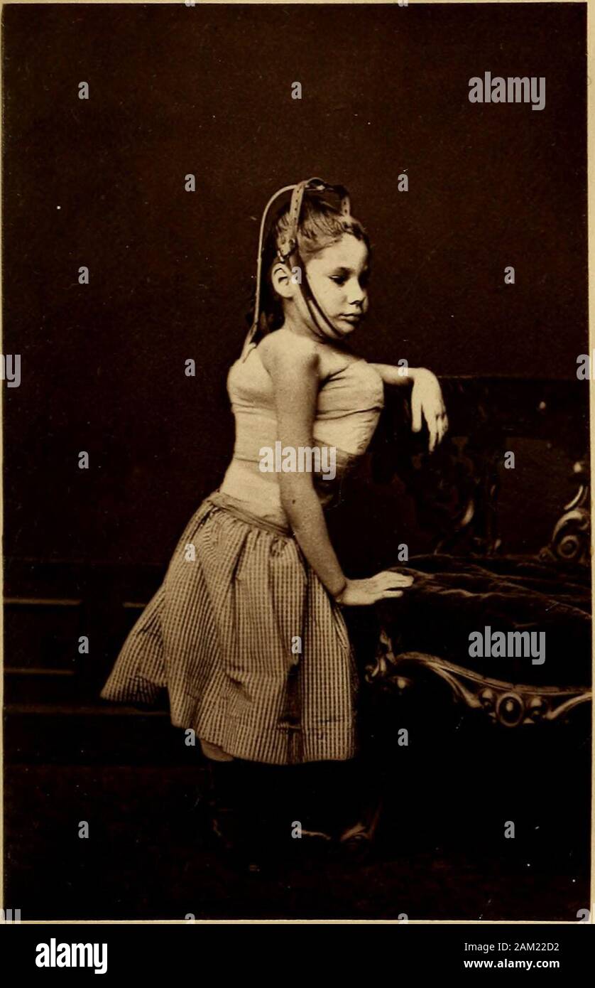 Spinal disease and spinal curvature : their treatment by suspension and ...