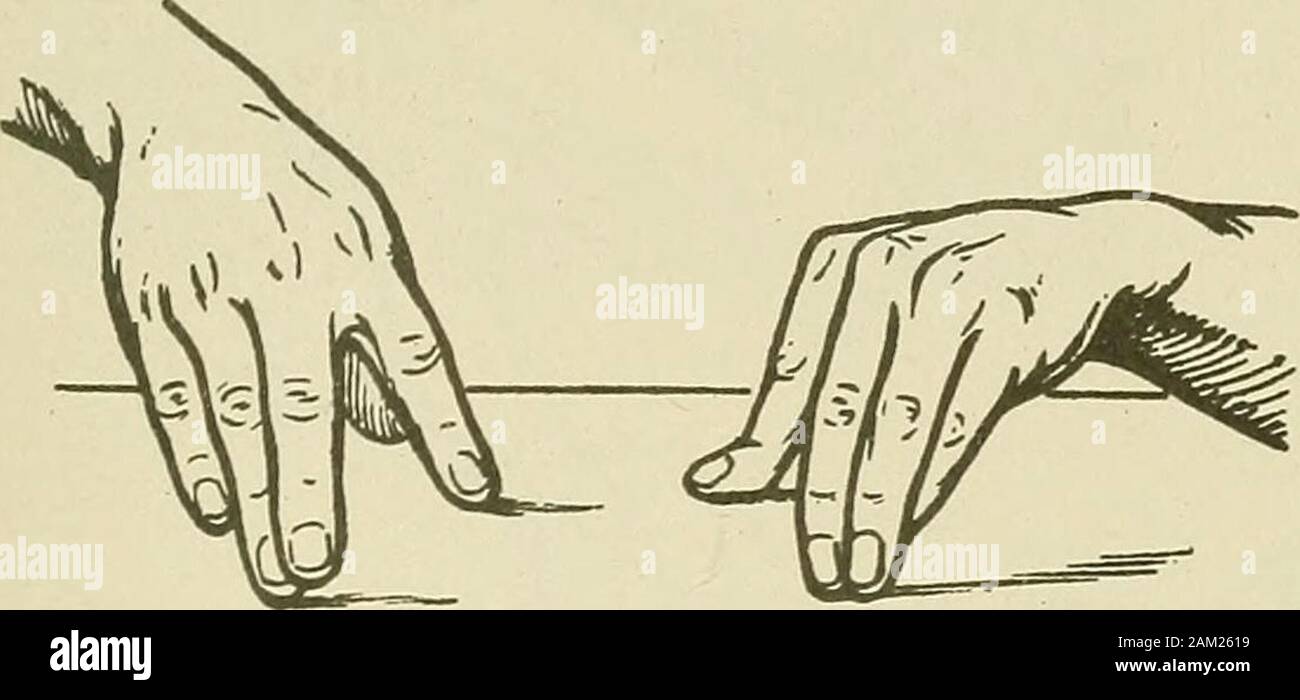 Hyperflexion hyperextension hi-res stock photography and images - Alamy