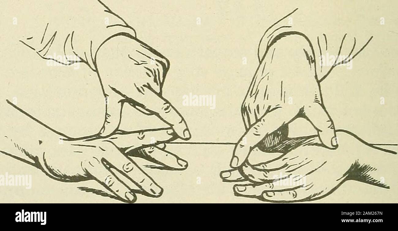 Ulnar reflex hi-res stock photography and images - Alamy