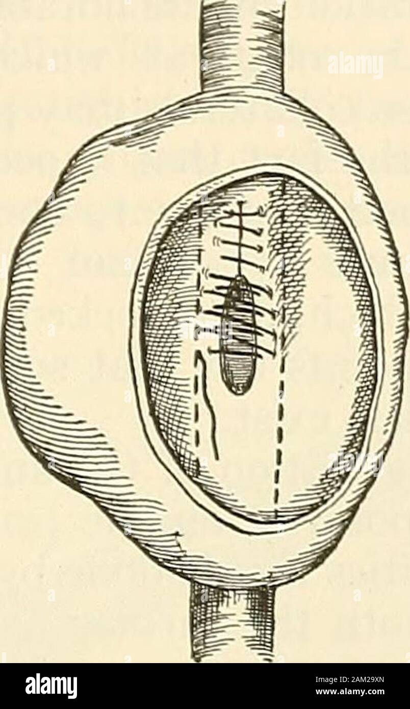 Modern surgery, general and operative . F Stock Photo - Alamy