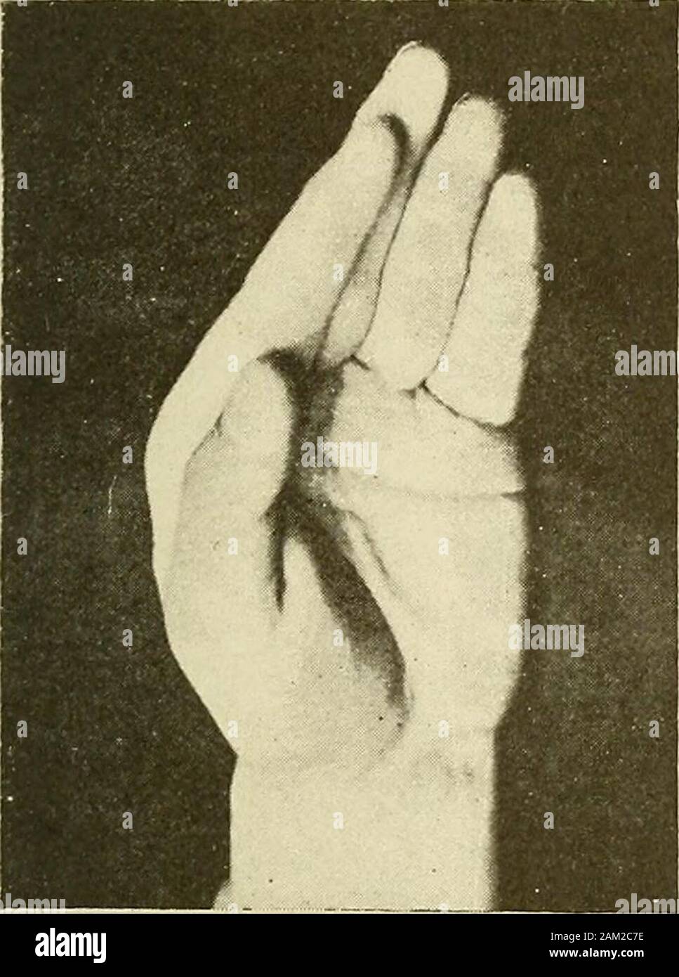 Medical and surgical therapy . THE ULNA (AugUSt 1914), one of the most ...