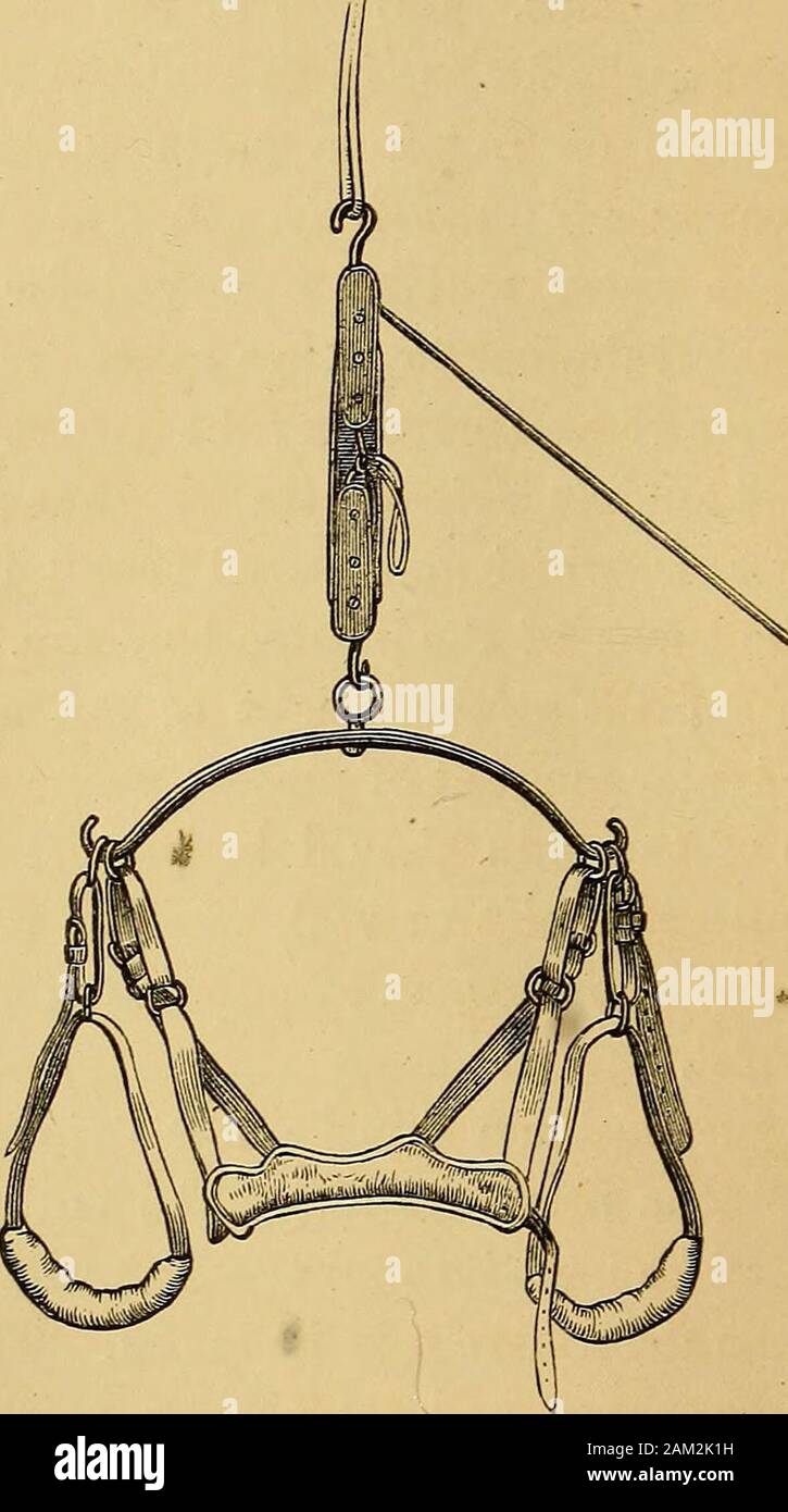 Spinal disease and spinal curvature : their treatment by suspension and ...