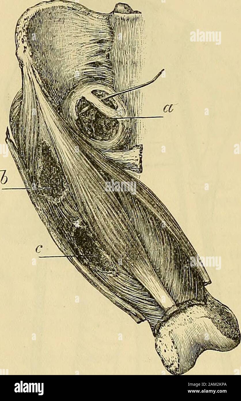 A system of surgery . rts outside the Fier, 452.—Abscesses in ...