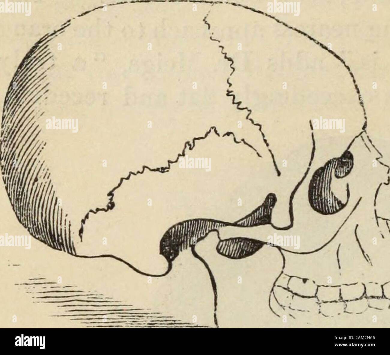 Maxillary prognathism hi-res stock photography and images - Alamy