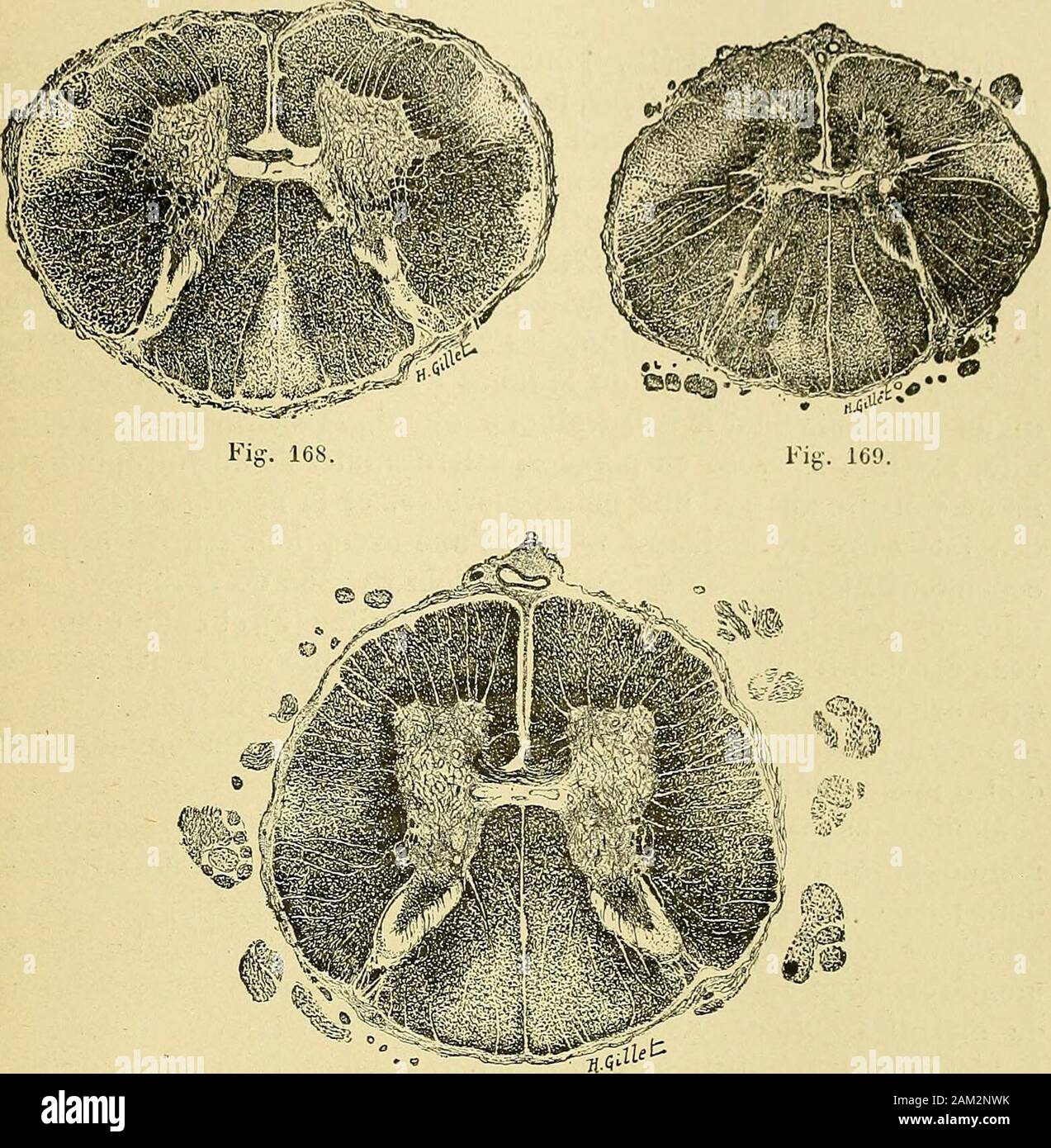 Cas de signe hi-res stock photography and images - Alamy